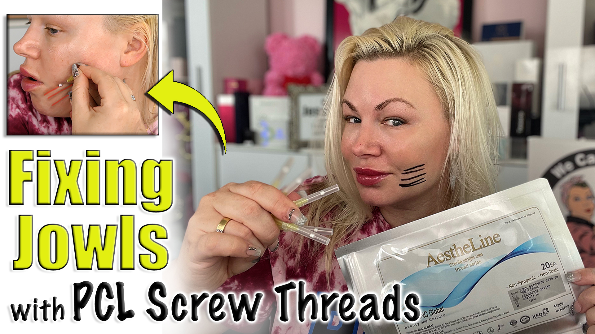 PCL Threads | Cog Threads | Thread Lifts | DIY Threads