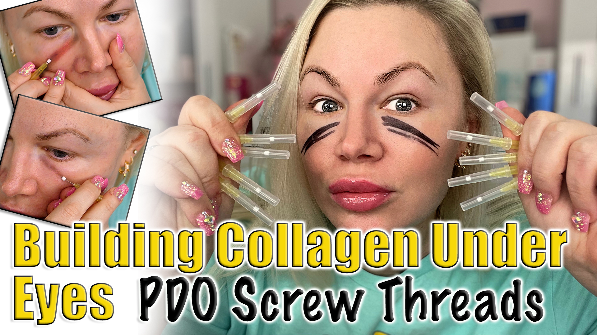 Under Eyes | Fix Dark Circles | Eye Puffiness